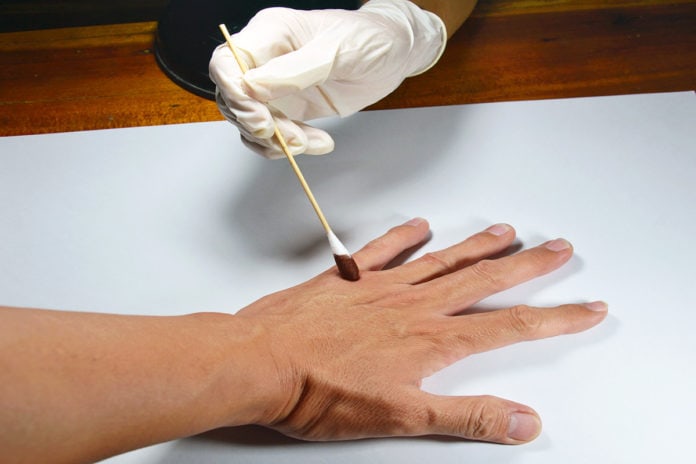Accident avec exposition au sang (AES) - dentalgest.com